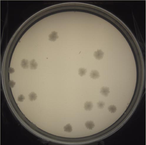 Clostridium perfringens is detected automatically